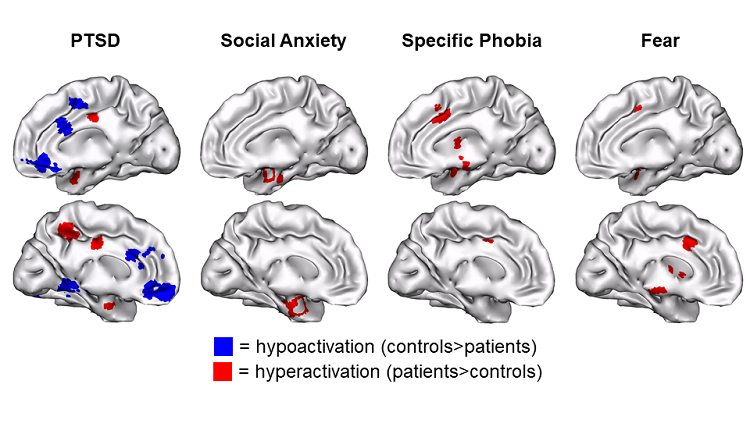 The Changing Face of Post-Traumatic Stress Disorder